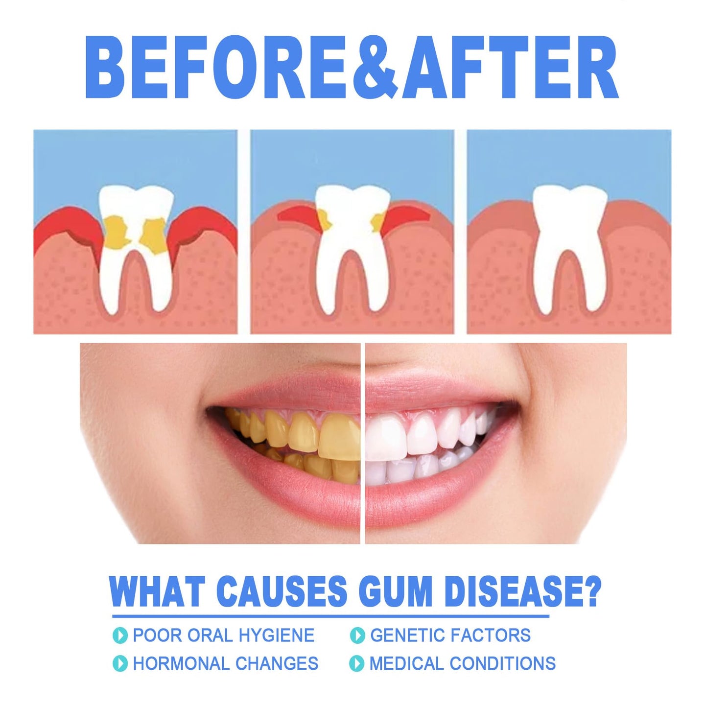 Mendall™ Gum Repair Gel